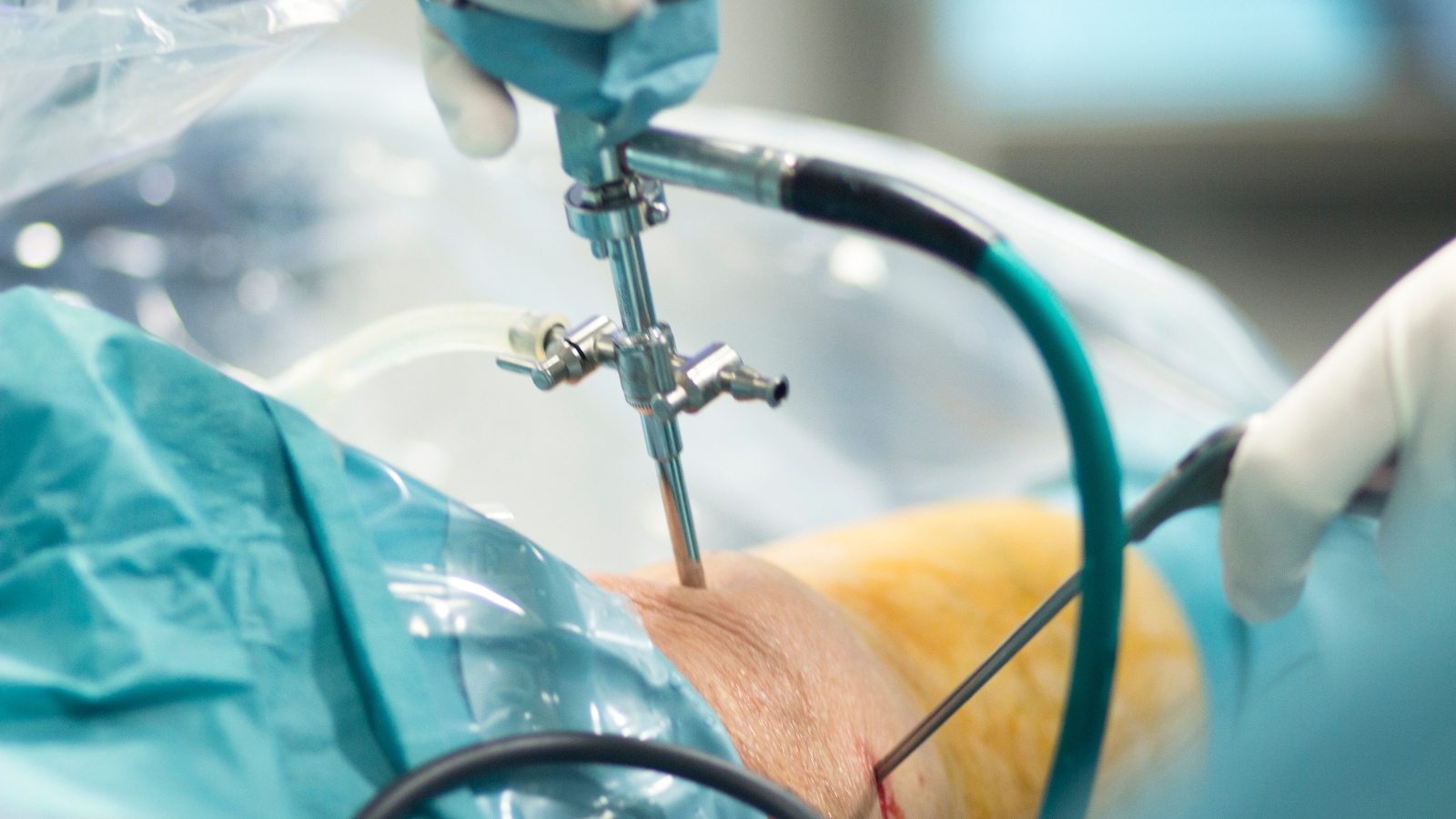 Ligamento cruzado anterior (LCA), lesión, diagnóstico y tratamiento