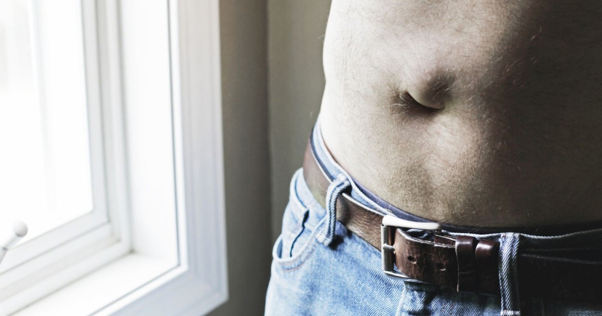 Hernia de ombligo en Adultos: ¿Hay que operar?