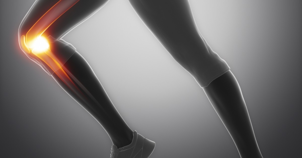 Rotura del ligamento lateral interno de la rodilla