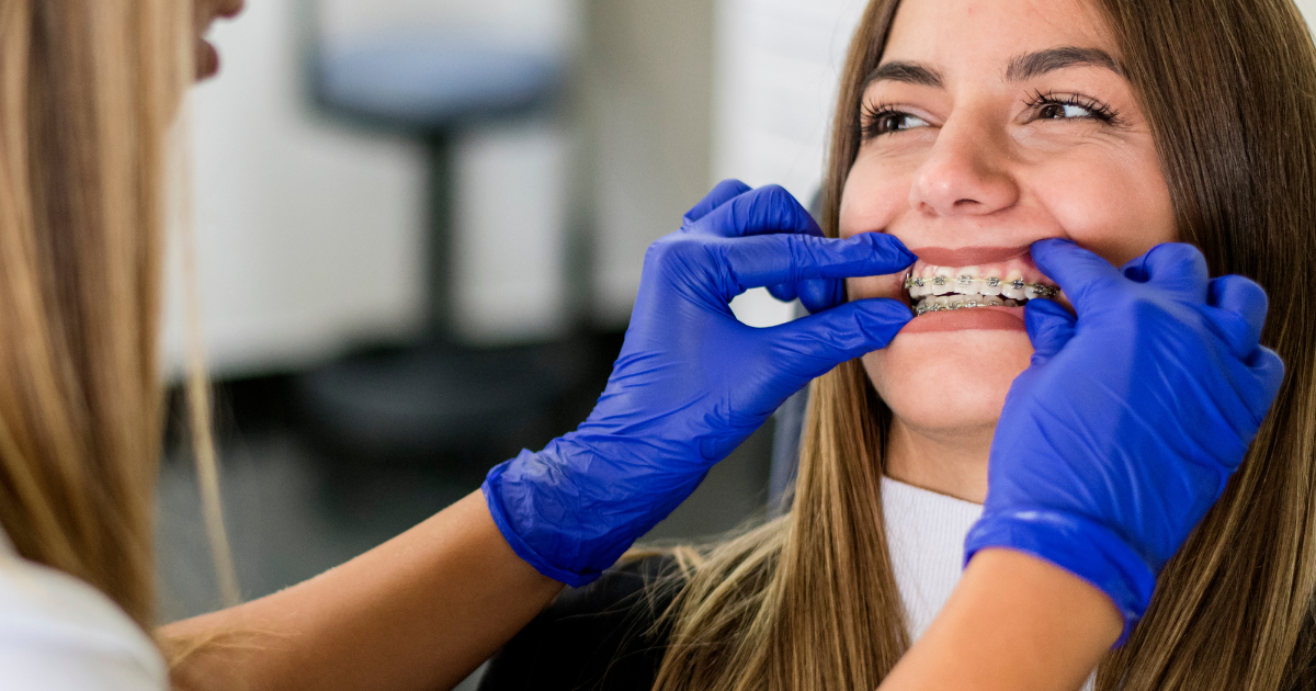 [2026] Precio de los Brackets: Tipos y Fases del tratamiento